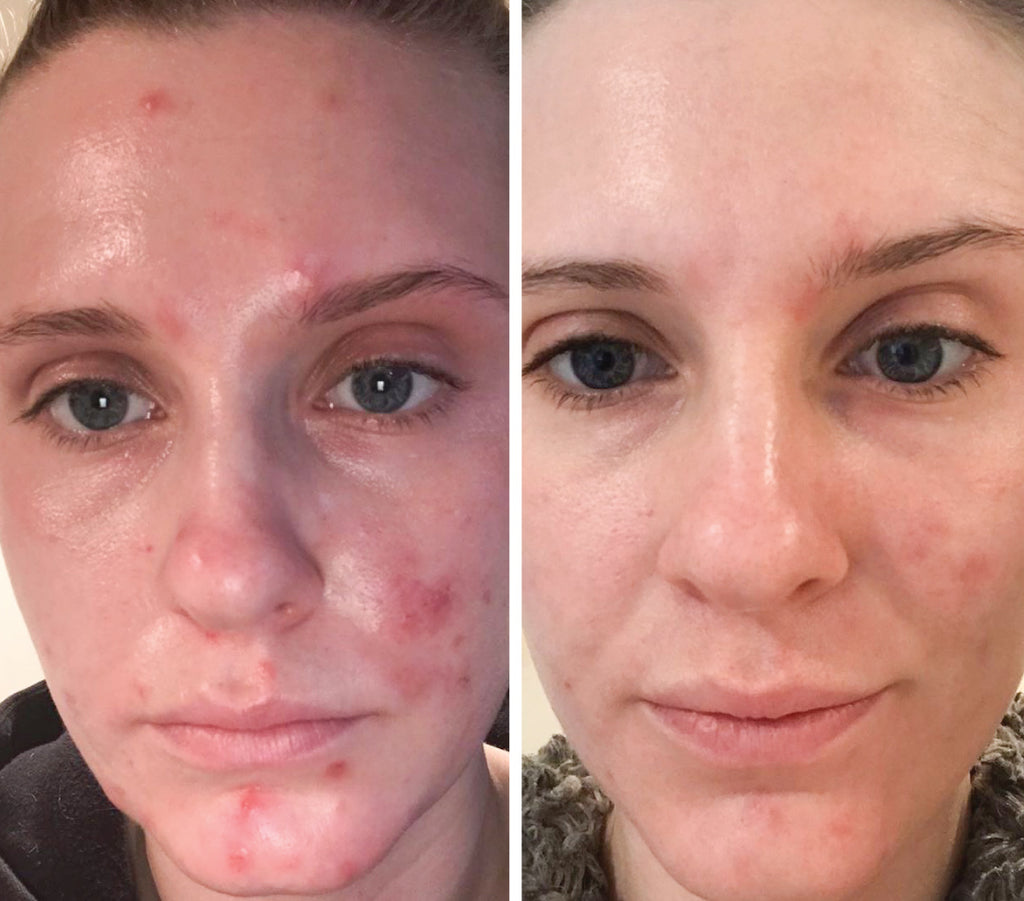 Earth Tones - Australian Red Clay Mask | Asarai